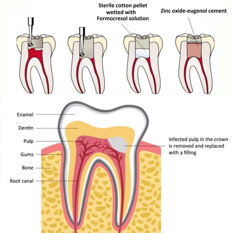 Service to Keep Baby Teeth Safe – Dr. Khullars