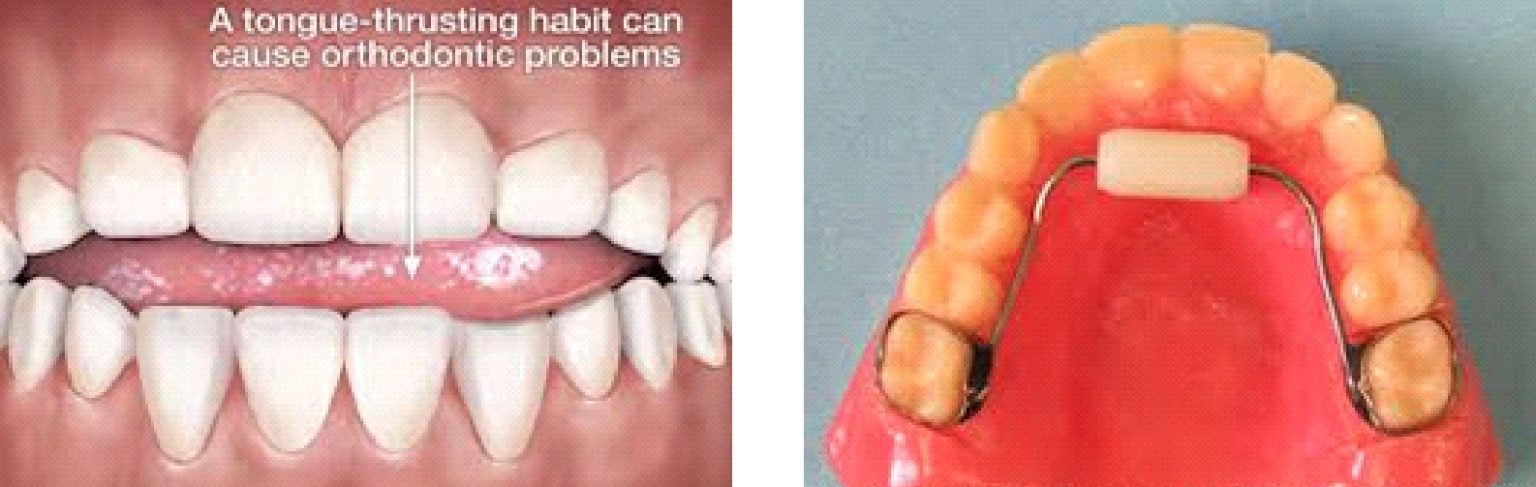 Service to Keep Baby Teeth Safe – Dr. Khullars